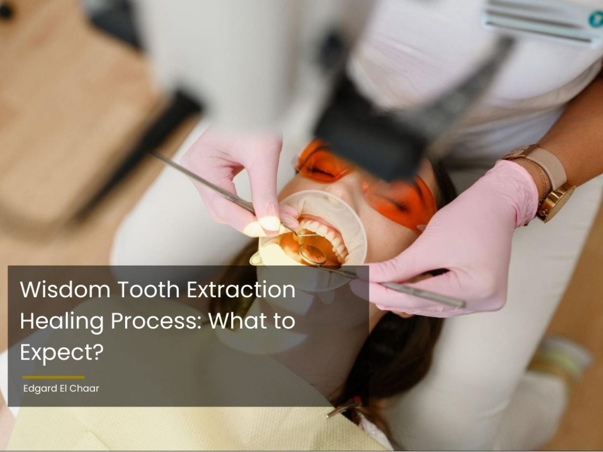 Wisdom Tooth Extraction Healing